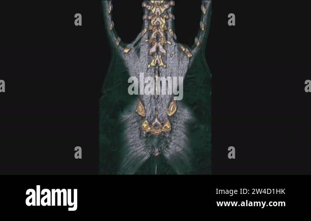 Bulk multicolored MRI of the female pelvic organs, abdominal cavity ...