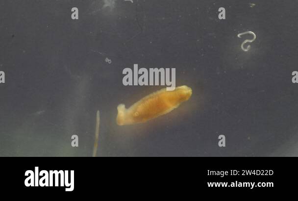 The study parasite or worms is a freshwater fish parasite in laboratory ...
