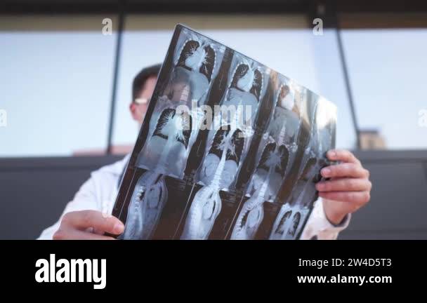 Doctor examines CT scan of chest and abdomen. X-ray or mri for the ...