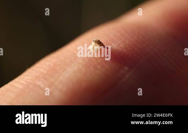 To protect bee uses the poison that admits into body of aggressor with ...