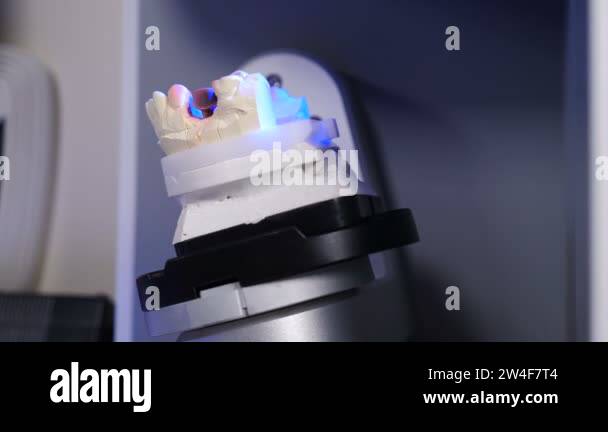 Dental technician scanning dental cast model in 3D surface scanners ...