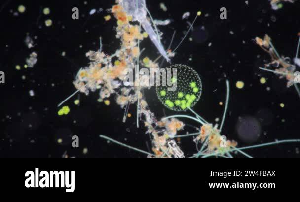 Volvox in drop of water under the microscope for classroom education ...