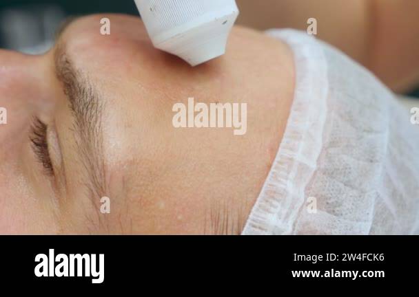 close-up of a mans face at the reception of a beautician. non-injection ...