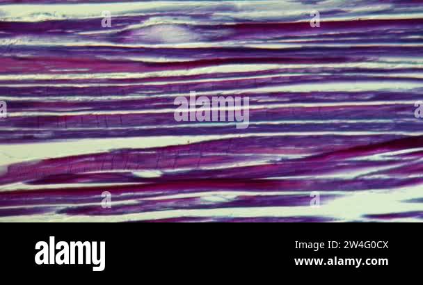 Striated muscles of the body at high magnification under the microscope ...