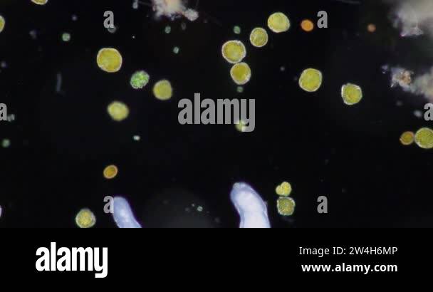 Chlorophyta microscope Stock Videos & Footage - HD and 4K Video Clips ...