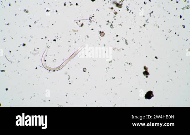 The small nematode is wiggling in the moss water with algae under ...