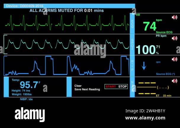 Ecg vital signs monitor Stock Videos & Footage - HD and 4K Video Clips ...
