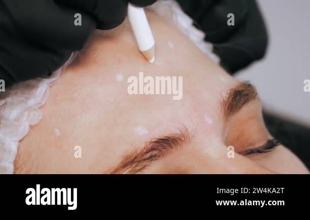 botox injection. beauty injection. anti-aging injections. botulinum ...