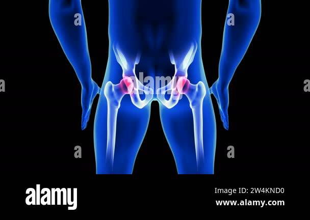 Hip Pain front view close-up animation. Blue Human Anatomy Body 3D Scan ...