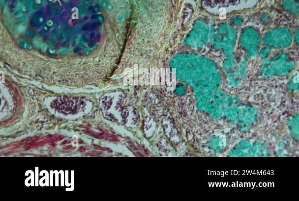 Diagnose asthma Stock Videos & Footage - HD and 4K Video Clips - Alamy