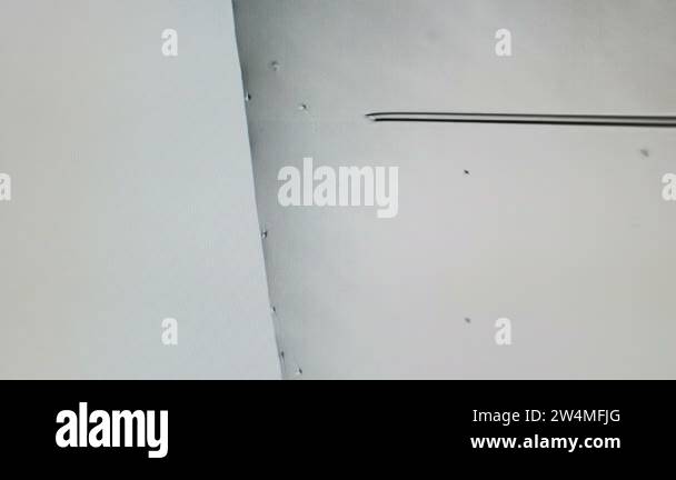 Intracytoplasmic sperm injection procedure. Shot by camera from ...