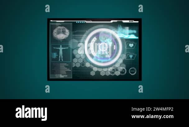 Animation of scopes scanning and medical data processing over digital screen. global medicine ...