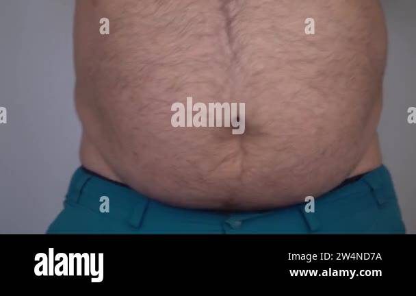 man shows his big belly and shakes his fat folds. problems of poor ...