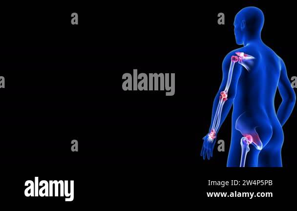 Joint Pain animation from side view - close-up. Blue Human Anatomy Body ...