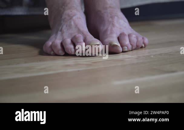 Sick elderly leg. Senior leg problems. Legs old woman with crippled ...