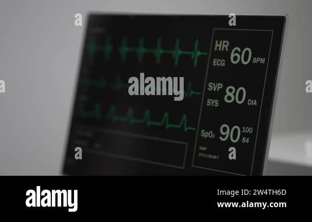 Looped: Patient monitor displays vital signs ECG electrocardiogram EKG ...