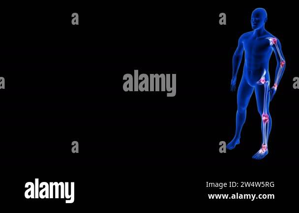 Joint Pain animation from side view. Blue Human Anatomy Body 3D Scan ...