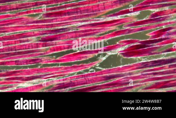 Striated muscles of the body at high magnification in darkfield under ...