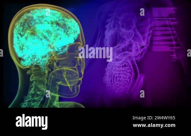 Brain neural impulses affect body systems concept - anatomy x-ray human ...
