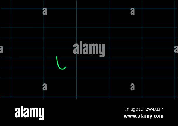 ECG Cycle In 4K. The Green Line Of The Heartbeat Pulse On The Black One ...