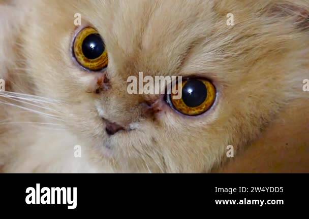 Mydriasis Stock Videos & Footage - HD and 4K Video Clips - Alamy
