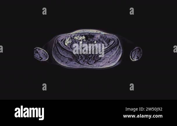 Bulk multicolored MRI of the female pelvic organs, abdominal cavity ...