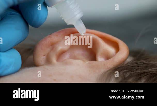 doctor dripping ear drops into patient ear. ear pain treatment and ...