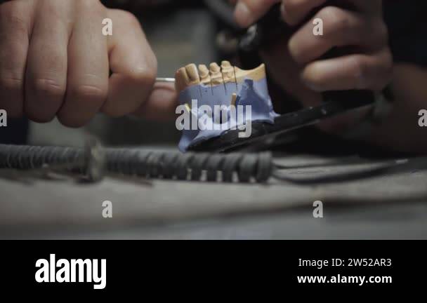 Dental technician work,teeth sharpening,denture milling,ceramic tooth ...