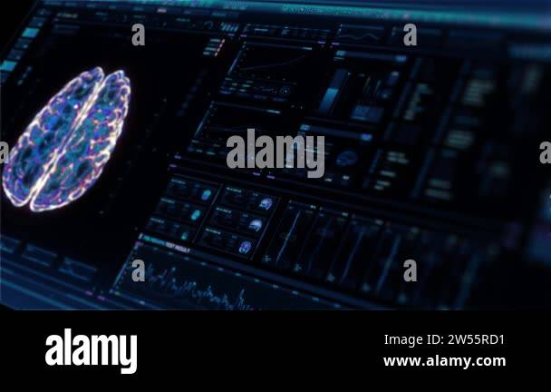 Holographic perspective interface analyzing human brain anatomy and ...