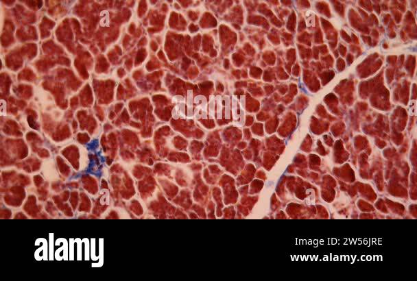 Pancreas with islet cells of Langerhan under the microscope 100x Stock ...