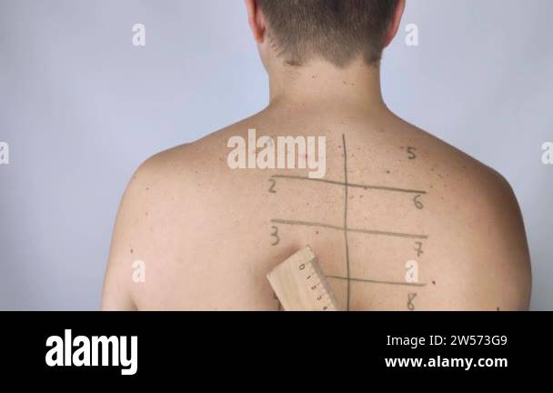 An allergist or dermatologist examines red spots on a mans face. The ...