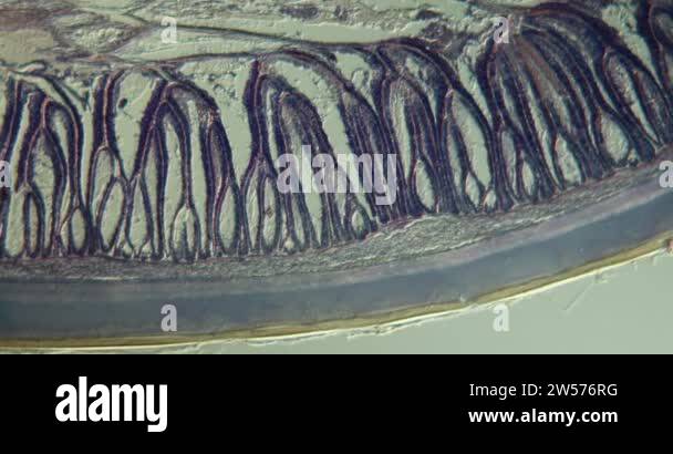 Roundworm microscope Stock Videos & Footage - HD and 4K Video Clips - Alamy