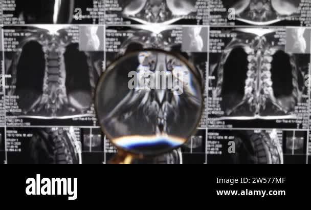 MRI lumbar spine background, magnetic resonance tomography. Doctor ...