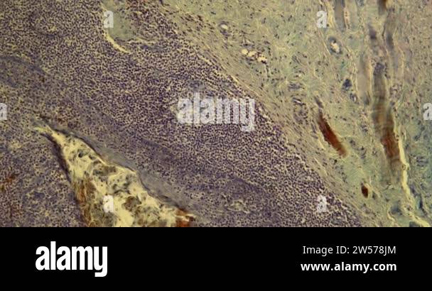 Tissue of the palatine tonsil under the microscope 100x Stock Video ...