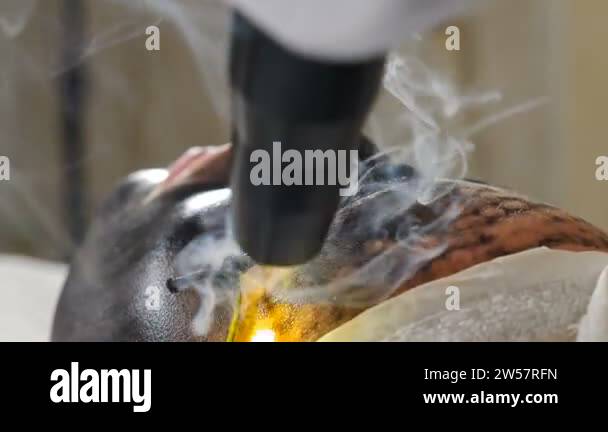 Beautician removes old skin with carbon fiber layer. Processing of ...