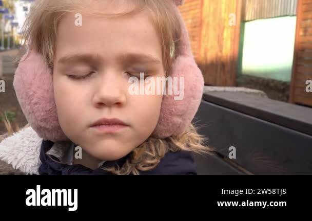 A bruise on the little girls left eye. bruised eyelid Stock Video ...