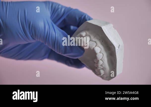 Dental impression plaster Stock Videos & Footage - HD and 4K Video ...