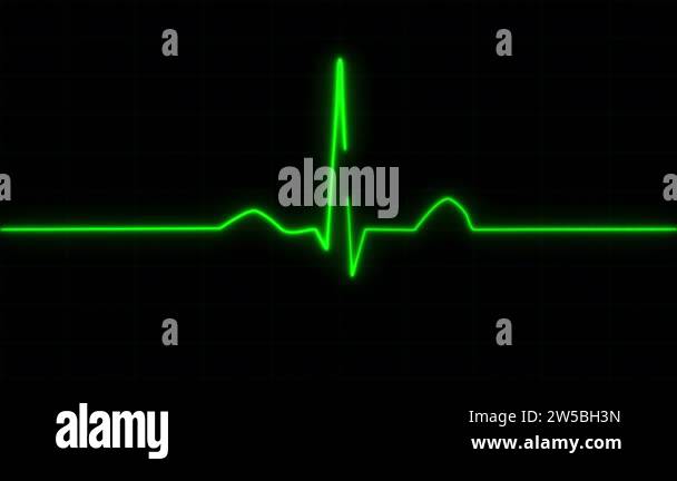 Concept 2-E1 Realistic heart pulse monitor animation on ...