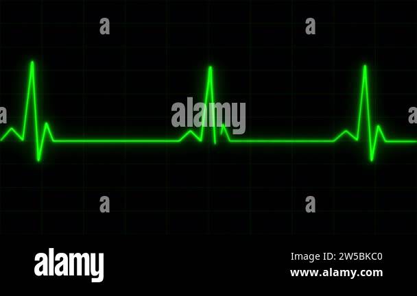 Concept 6-E1 Realistic heart pulse monitor animation on ...