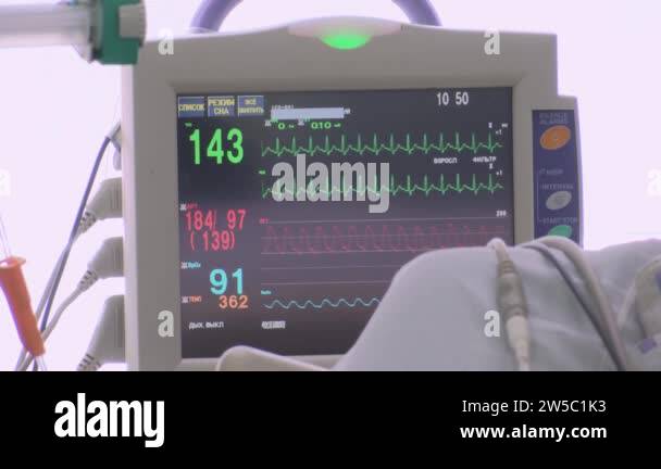 Monitor Of The Artificial Lung Ventilation Device On The Monitor That ...