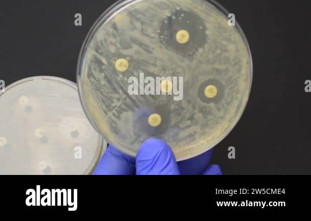 Antimicrobial resistance testing Stock Videos & Footage - HD and 4K ...