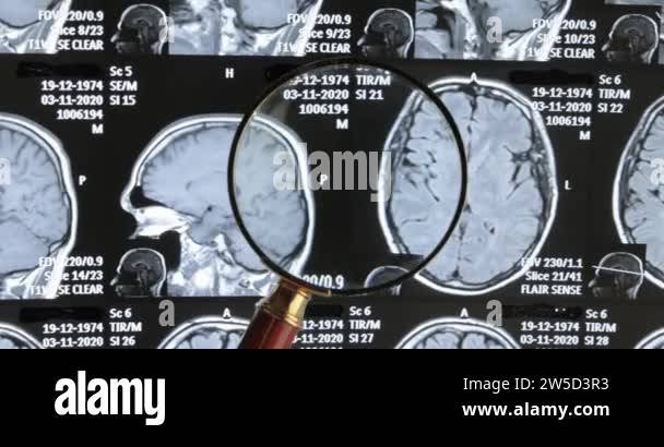 Mri brain scan background, magnetic resonance tomography. The doctor ...