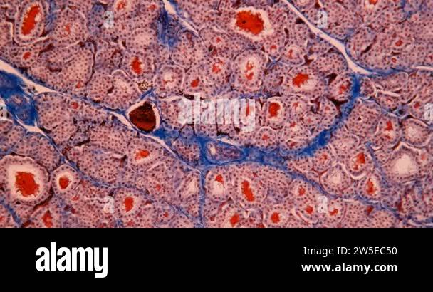 Thyroid gland with colloid under the microscope 100x Stock Video ...