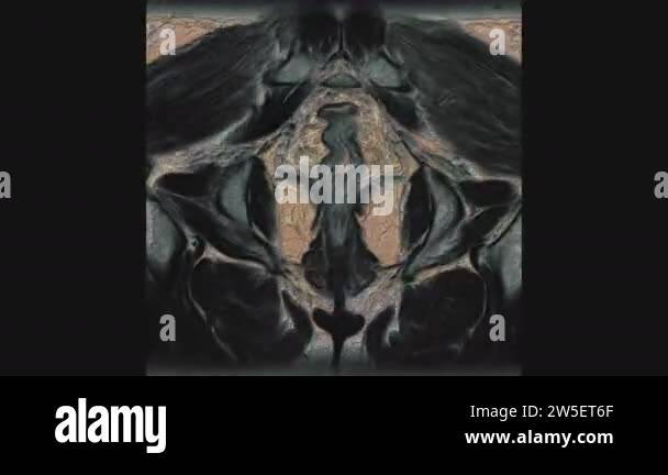 Bulk multicolored MRI of the female pelvic organs, abdominal cavity ...