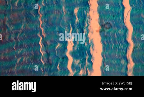 Tendon tissue Stock Videos & Footage - HD and 4K Video Clips - Alamy