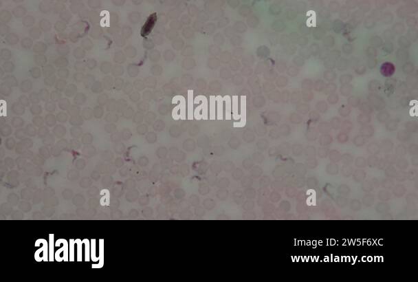 Trypanosoma Stock Videos & Footage - HD and 4K Video Clips - Alamy