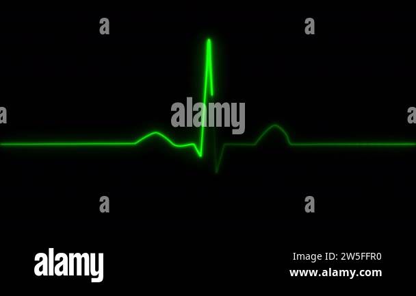 Concept-E1 Realistic heart pulse monitor animation on electrocardiogram ...