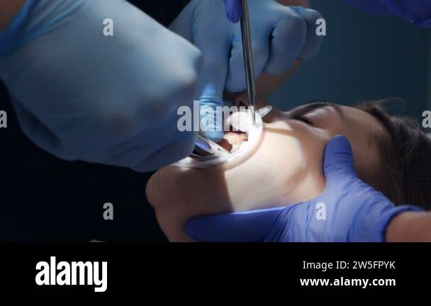 Dentist using surgical pliers to extract a tooth in the dental office ...