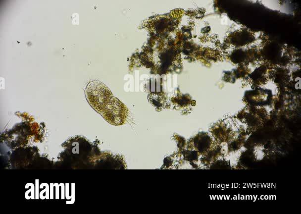 unicellular microorganism under the microscope Stock Video Footage - Alamy