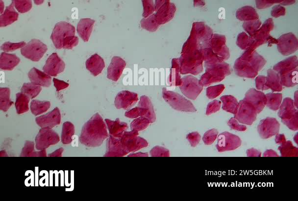 Oral mucosa Stock Videos & Footage - HD and 4K Video Clips - Alamy